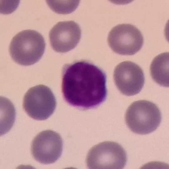 BLOOD CELL DETECTION_NEW SMALL DATASET Object Detection Dataset and Pre ...