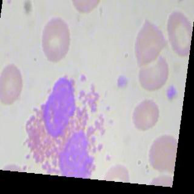 WBCs - Roboflow Universe