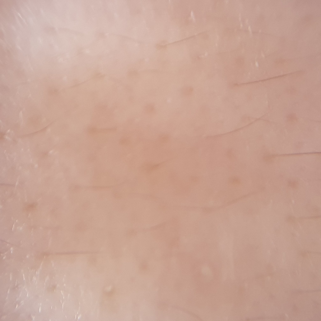 skin pore Object Detection Dataset by foodrecog