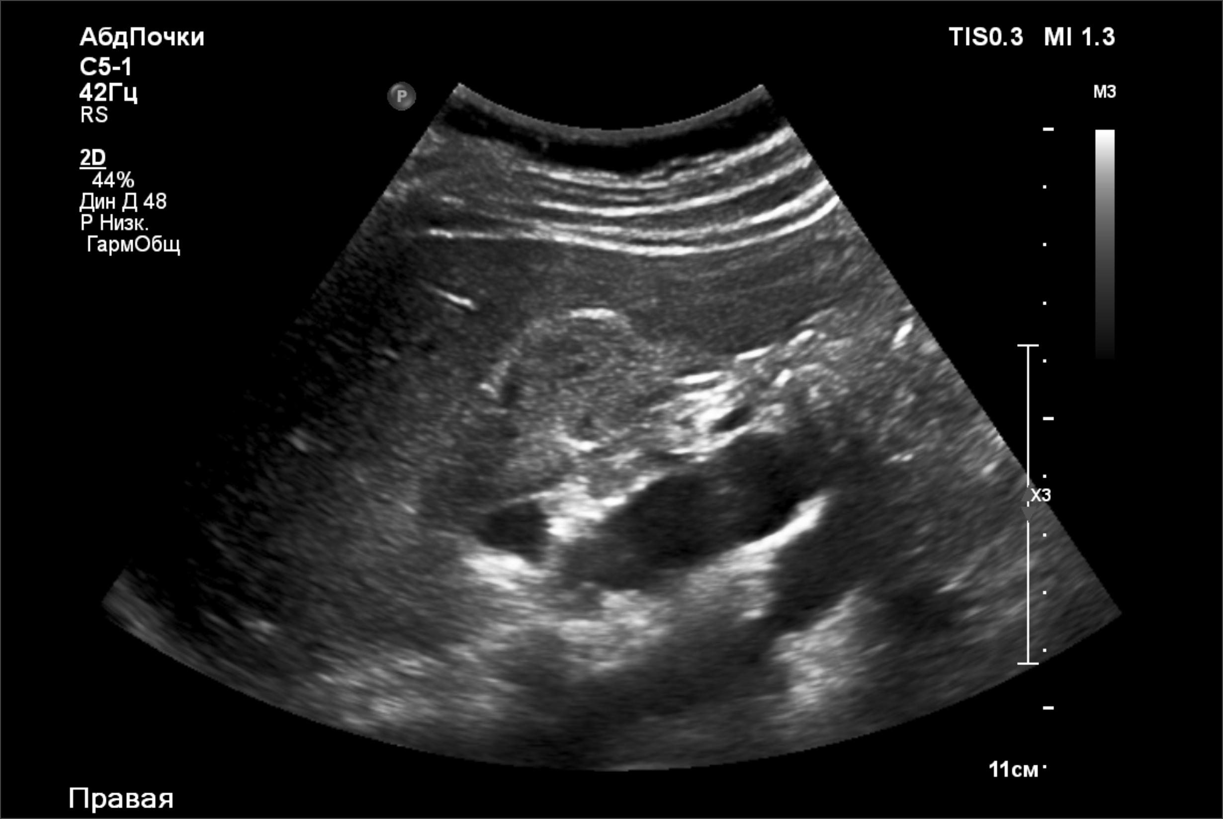 How to Use the tumor-and-other Object Detection API