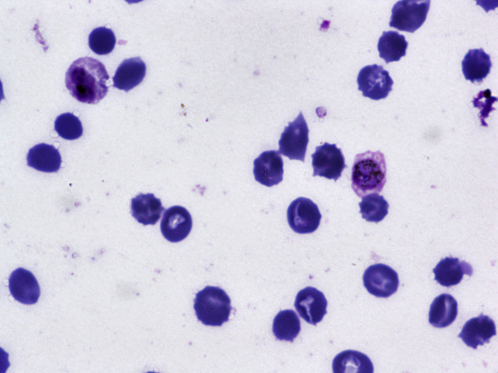 Malaria Detection Object Detection Dataset And Pre Trained Model By