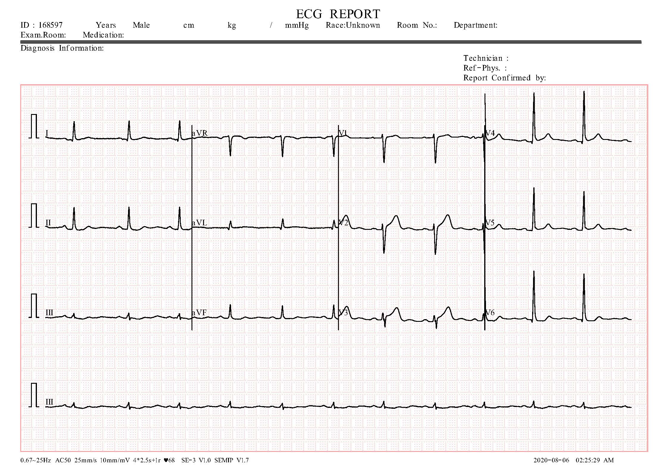 Ecg Lead detection Object Detection Dataset and Pre-Trained Model by ...