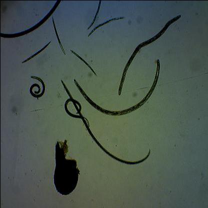 nematodes augment 3 Object Detection Dataset by parasitenoparasite