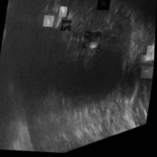 kidney stone detection@ Classification Dataset by selamina