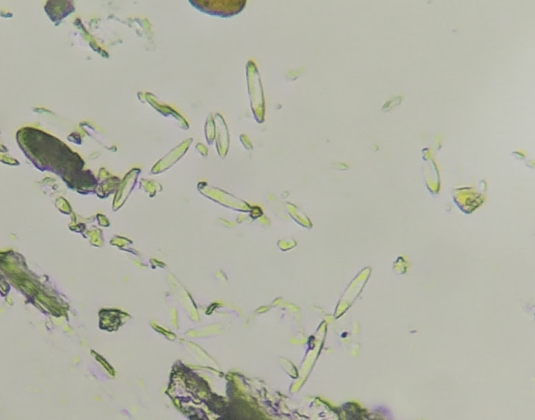 Ramularia - Roboflow Universe