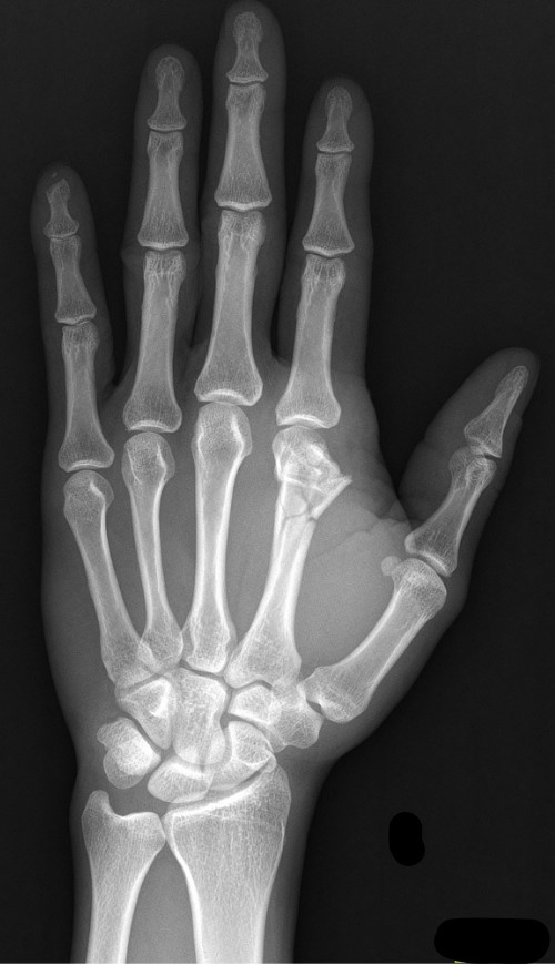 How to Use the Scaphoid-scanner Object Detection API