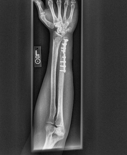 Science Research 2023: Binary Classification: ResNet-50 V1 Classification Dataset (v1, 2022-11 ...