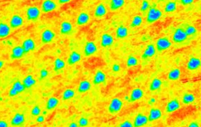 tree detection Object Detection Dataset and Pre-Trained Model by rpas