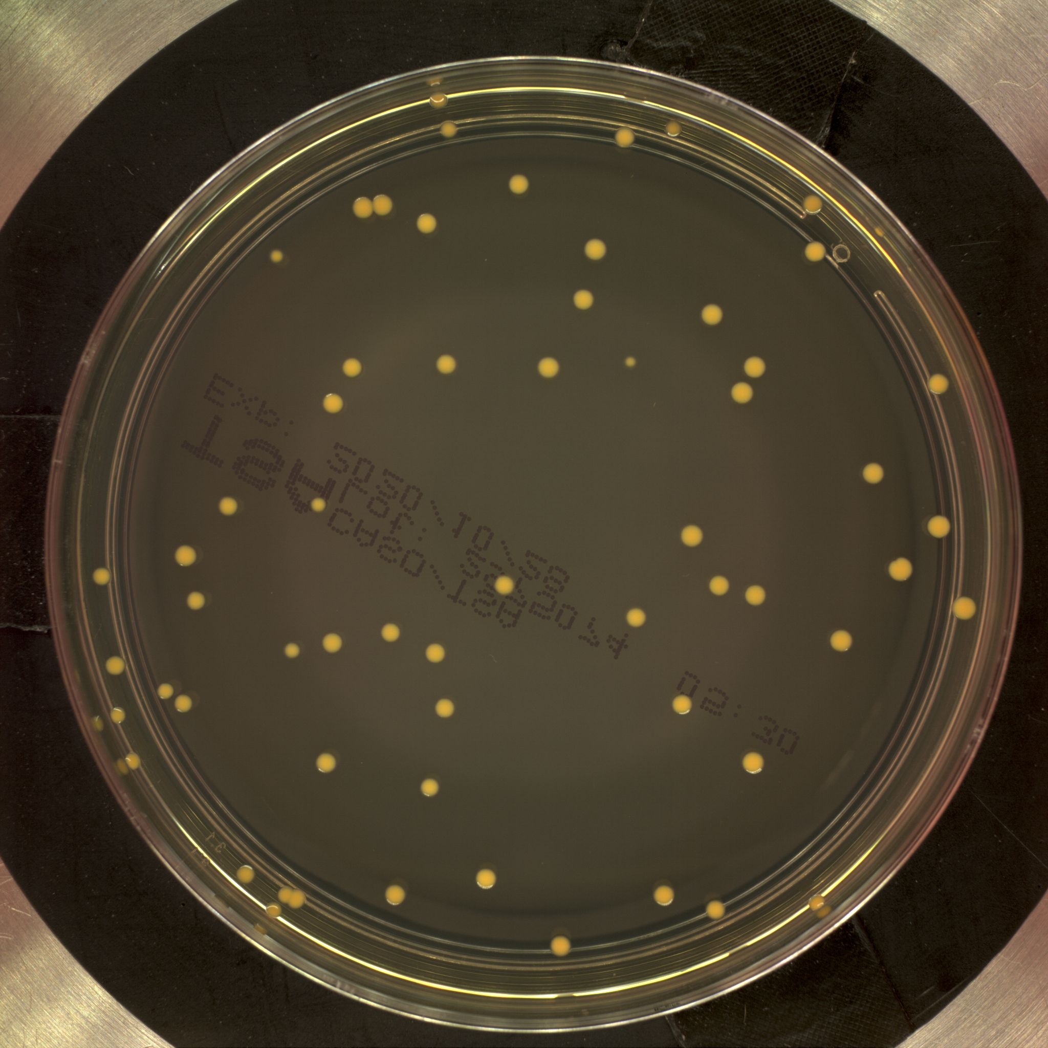 Bacteria Colony Object Detection Instance Segmentation Dataset And Pre