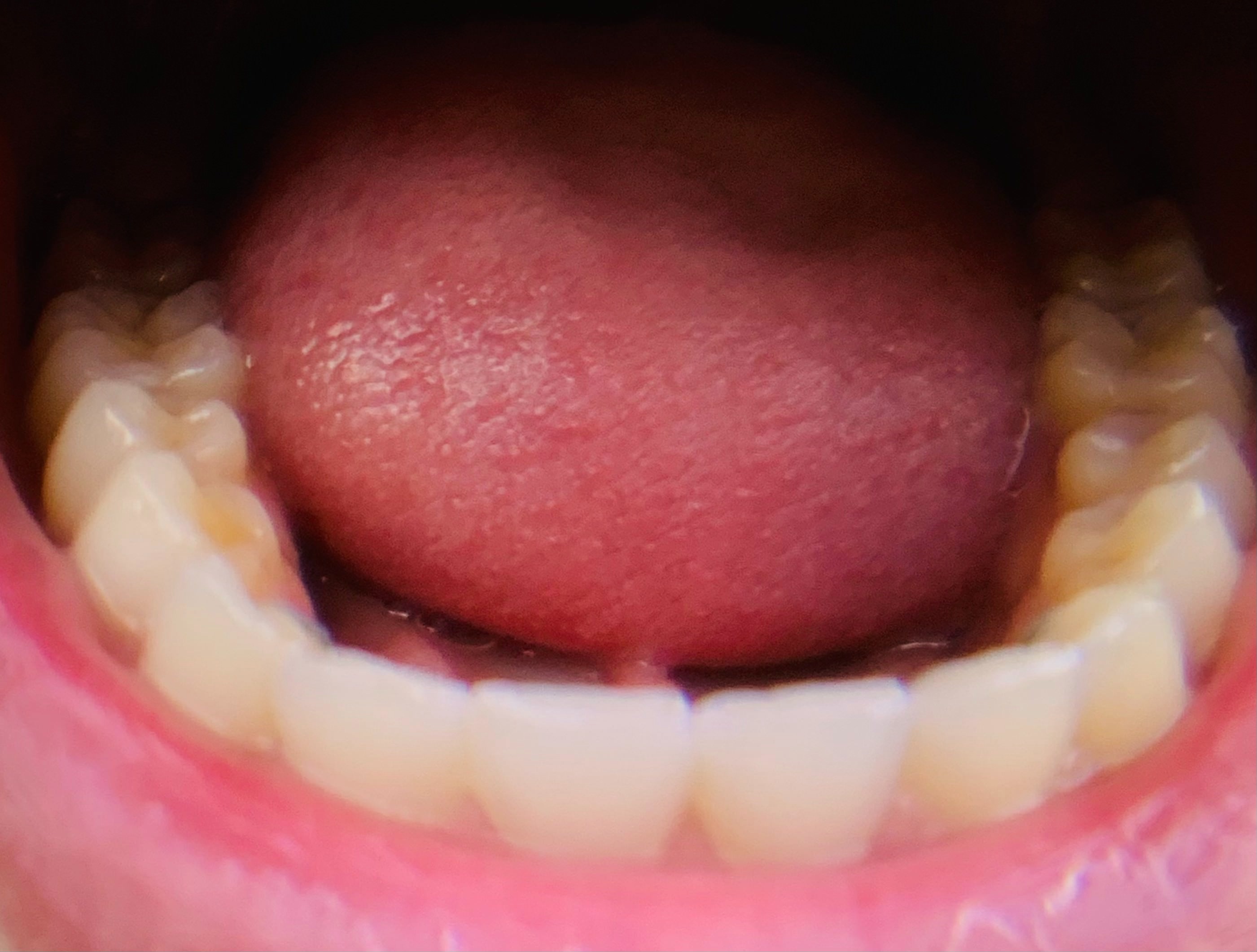 Philip Gast - Roboflow Universe