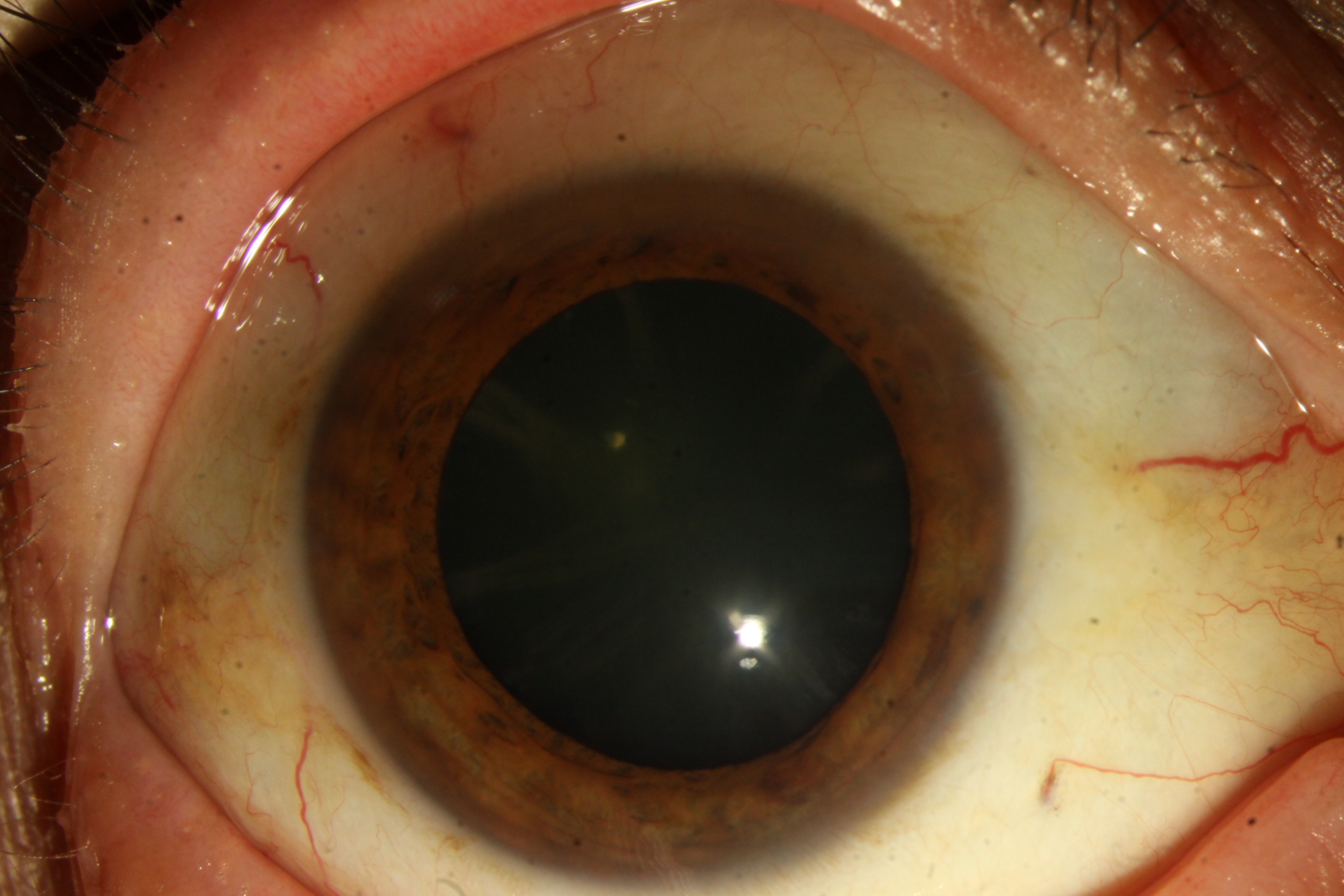 Iris Recognition Object Detection Dataset and Pre-Trained Model by University of Mumbai
