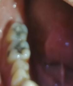 curuk_dis_test Object Detection Dataset by ibrahim Biner