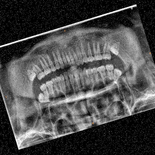 teeth Object Detection Dataset by ibrahim Biner