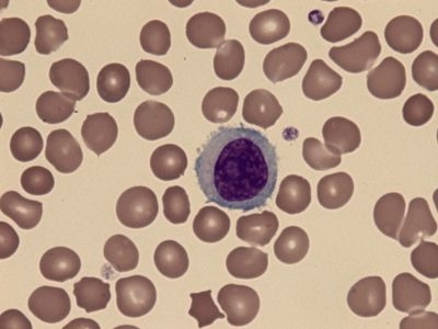 white cells Object Detection Dataset by Hyeonjun (Jello)