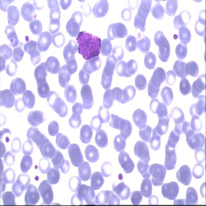 WBC classification Object Detection Dataset and Pre-Trained Model by GOUTAM JOSHI