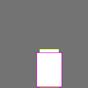 X ray bone fracture Object Detection Dataset and Pre-Trained Model by Unit