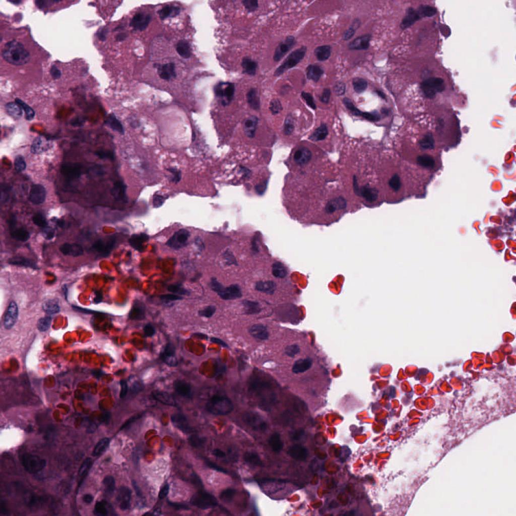 cell_detect_33 Object Detection Dataset by Ocelot