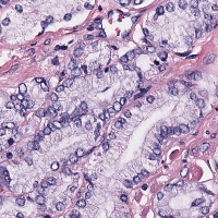 cell_detect Object Detection Dataset and Pre-Trained Model by Ocelot