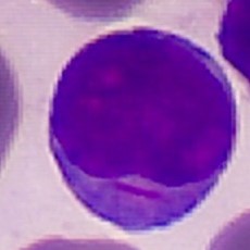 aml Object Detection Dataset by derek lio