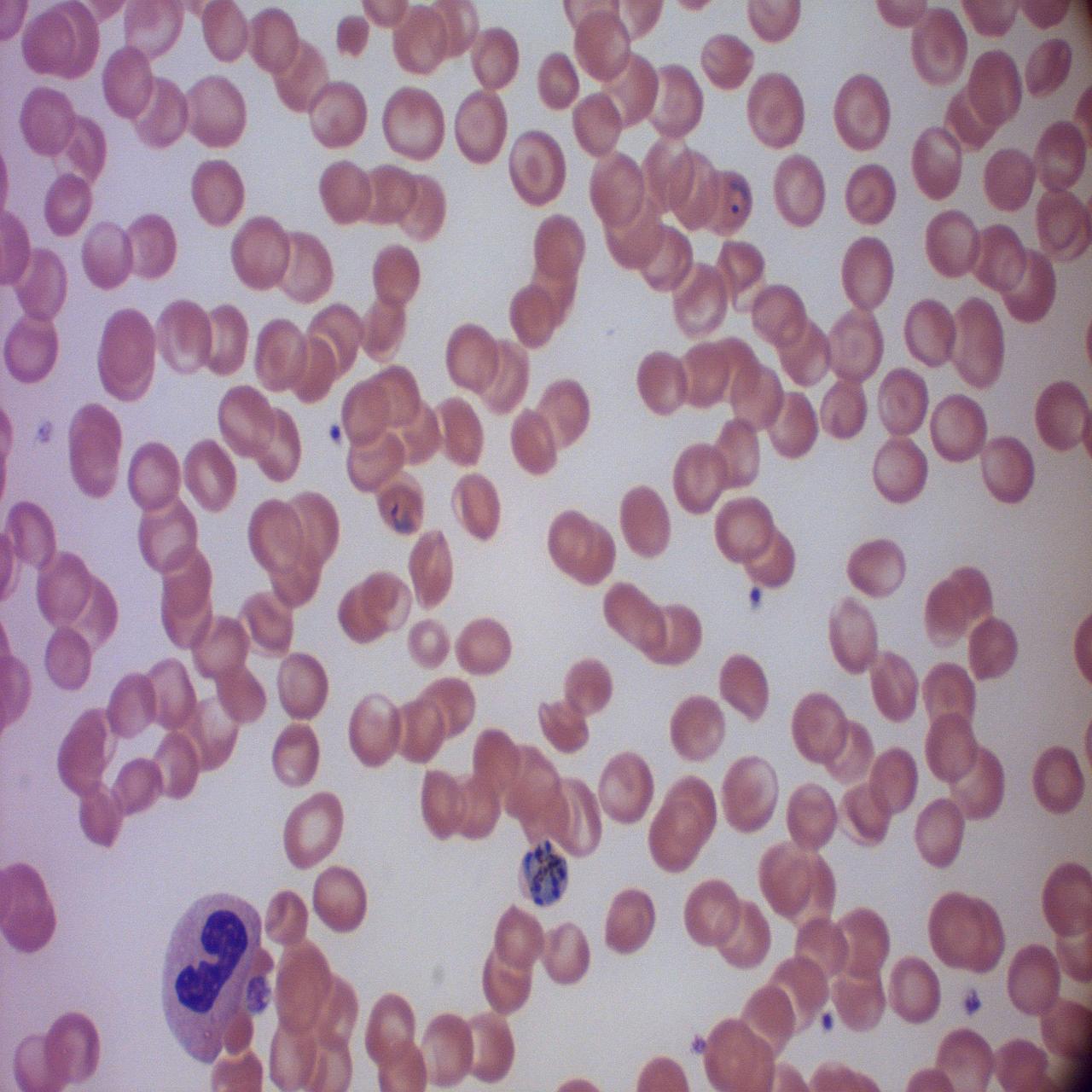 Malaria Object Detection Dataset by Luca Zedda