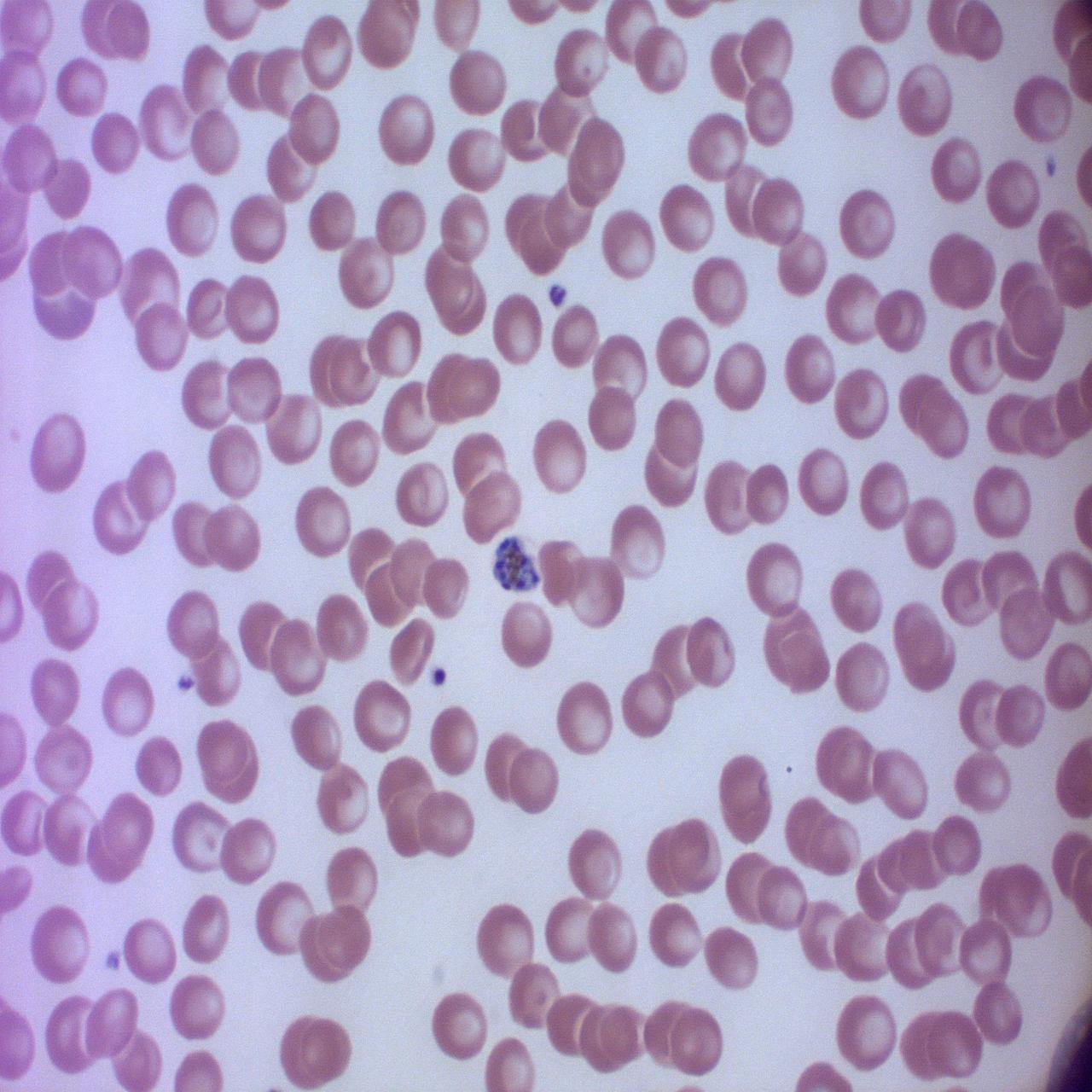 Malaria 3 Object Detection Dataset By Luca Zedda