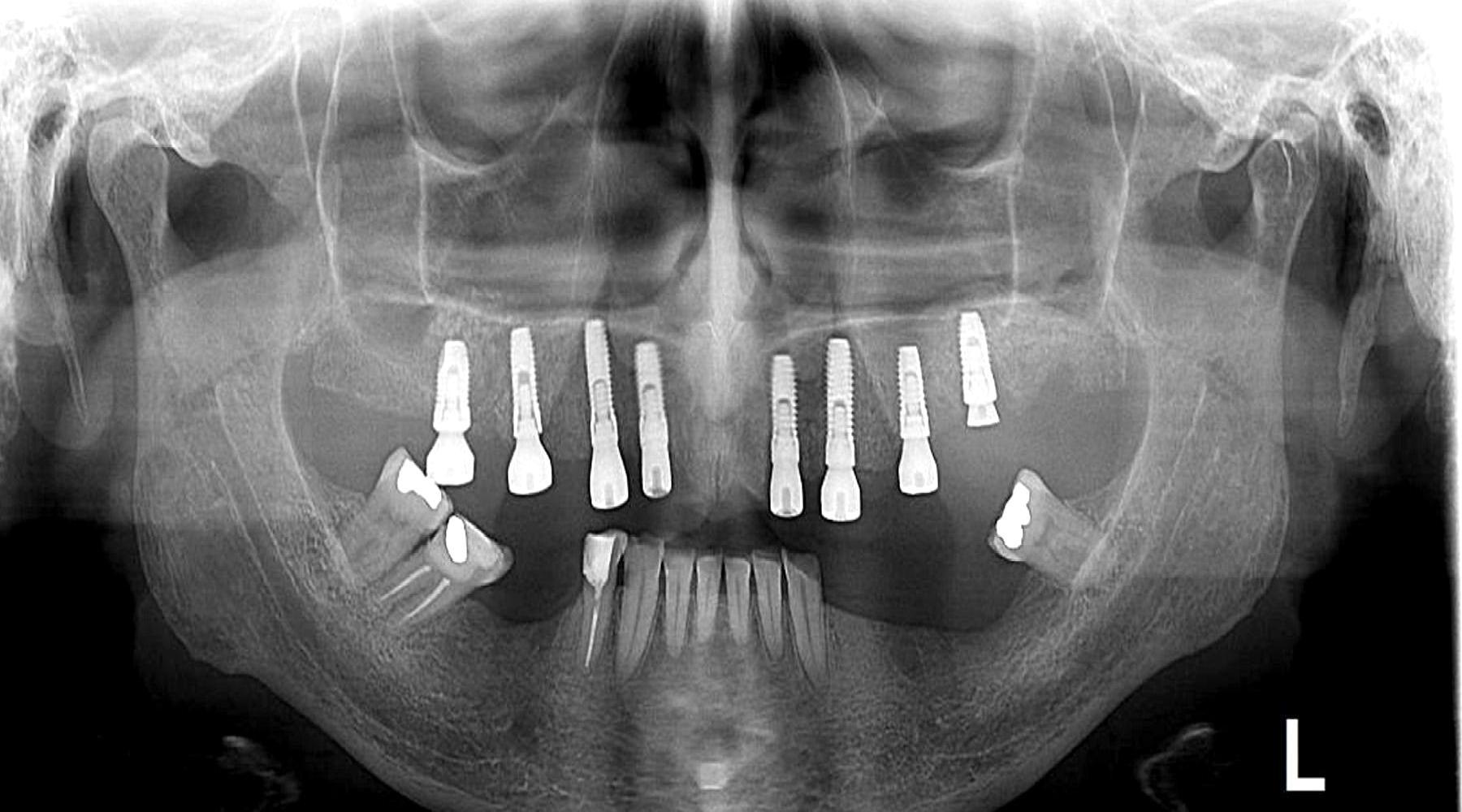 Tooth Instance Segmentation Tooth Instance Segmentation Ks7aj 3149