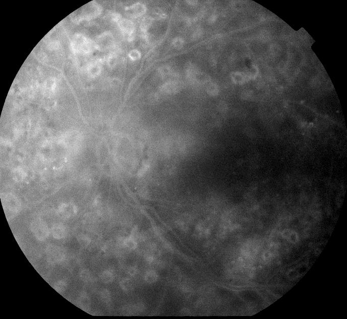 Zanzon Workspace - Roboflow Universe