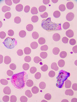 blood_cell_detection Object Detection Dataset and Pre-Trained Model by hima