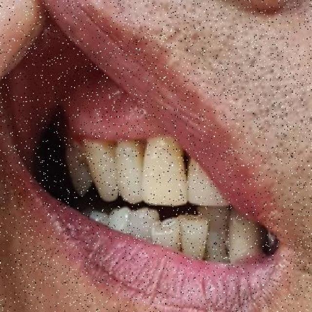 Teeth Shade Classification Instance Segmentation Dataset and Pre-Trained Model by Teeth shade ...