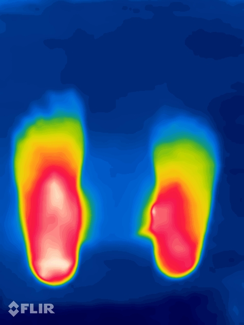 Diabetes_Project Object Detection Dataset and Pre-Trained Model by NII