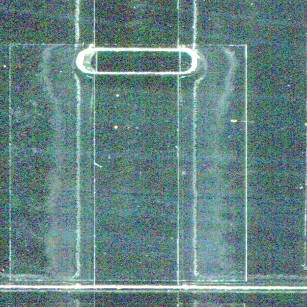 lamel seg Instance Segmentation Dataset by new-workspace-jhbri