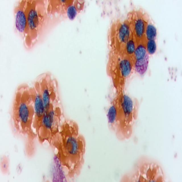 How to Use the LS-2024-Monocytes Object Detection API