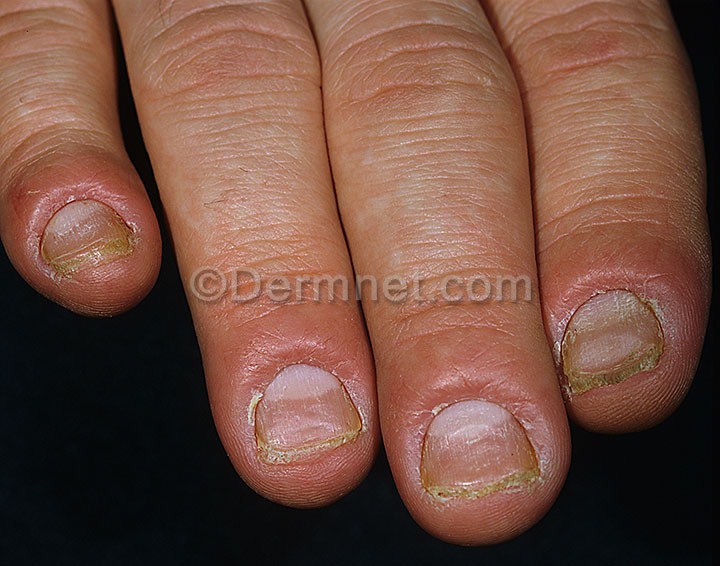 Nail Project Object Detection Dataset by Tim Lauer