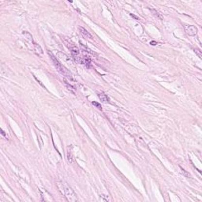 conic-gtlabel-image-dataset-c Object Detection Dataset (v2356, 2022-09 ...