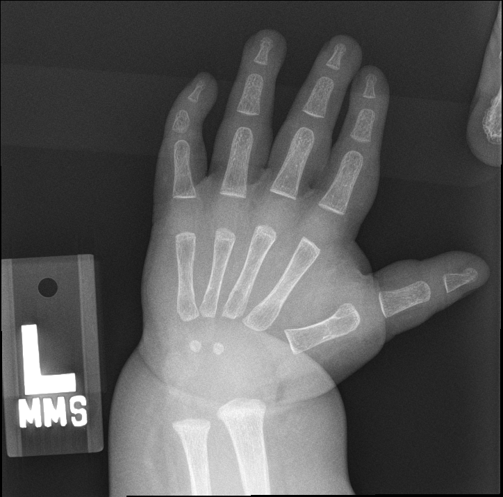 Hand Joint - Roboflow Universe