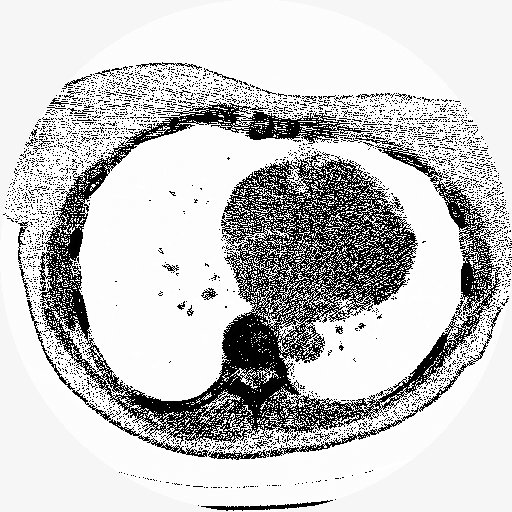 Lungs Object Detection Dataset And Pre Trained Model By Universidad Cadiz