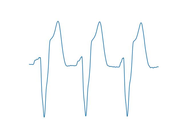Triplet New Object Detection Dataset By Ivr