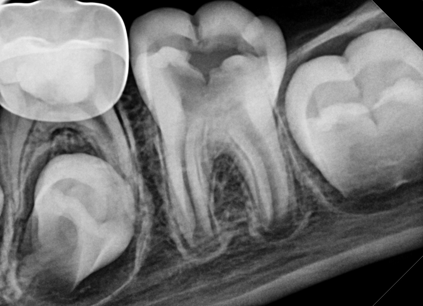dental annotation Object Detection Dataset by dent dataset dental annotation Object Detection Dataset by dent dataset