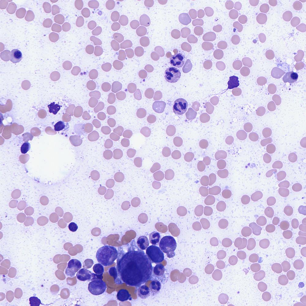 cancer_cell_detect Object Detection Dataset and Pre-Trained Model by Detect Cells