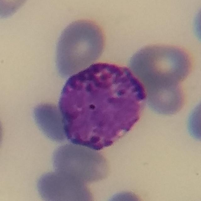 BCC-test Object Detection Dataset by Blood Cell Count