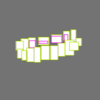 cavity Object Detection Dataset and Pre-Trained Model by kim o sans