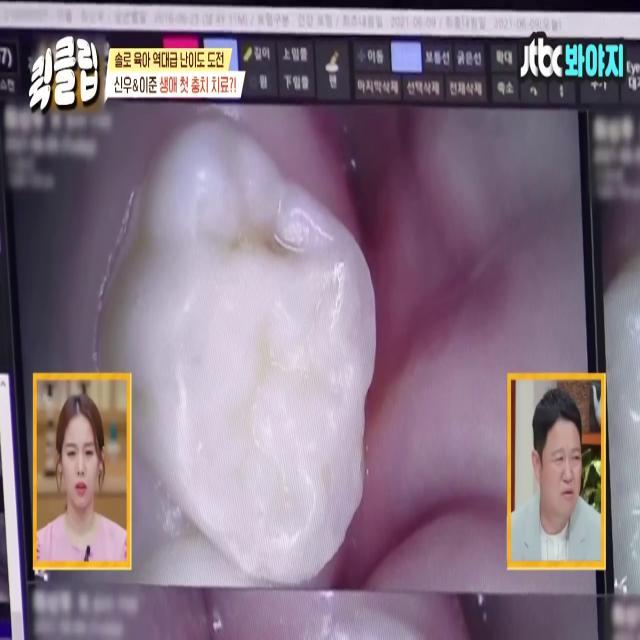 cavity Object Detection Dataset and Pre-Trained Model by kim o sans