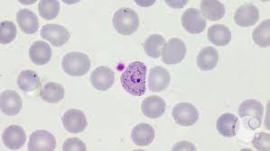 malaria Detection Object Detection Dataset and Pre-Trained Model by pvp ...