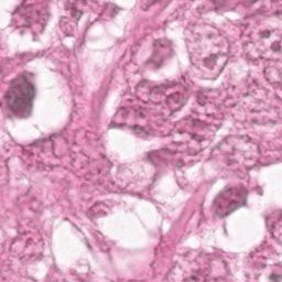 macenko_normalization Object Detection Dataset and Pre-Trained Model by ...