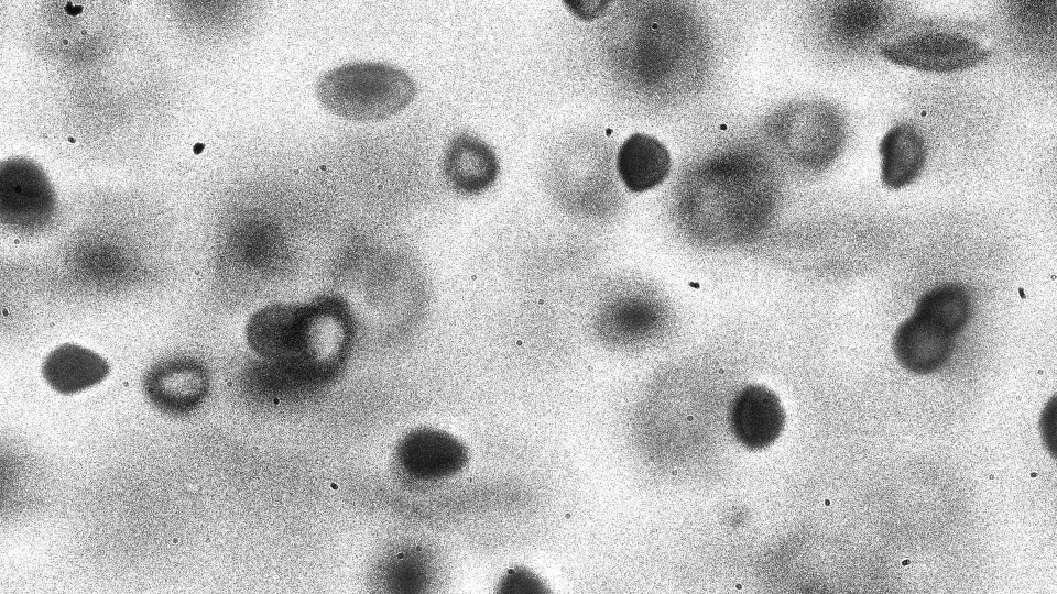 Detecting Sickle Cells in Blood Object Detection Dataset and Pre-Trained Model by sickle cell ...