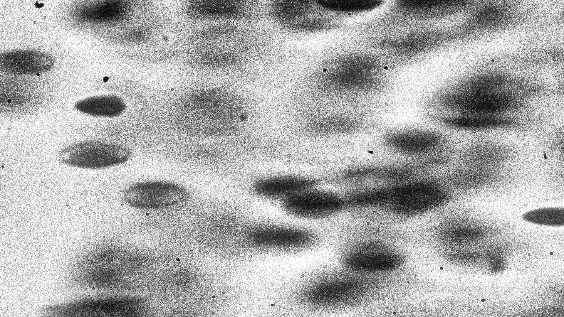 scc Object Detection Dataset and Pre-Trained Model by sickle cell classifications