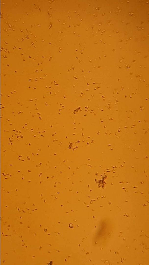 Sperm Segmentation M1 Instance Segmentation Dataset V1 2023 10 07 6 42am By Projects