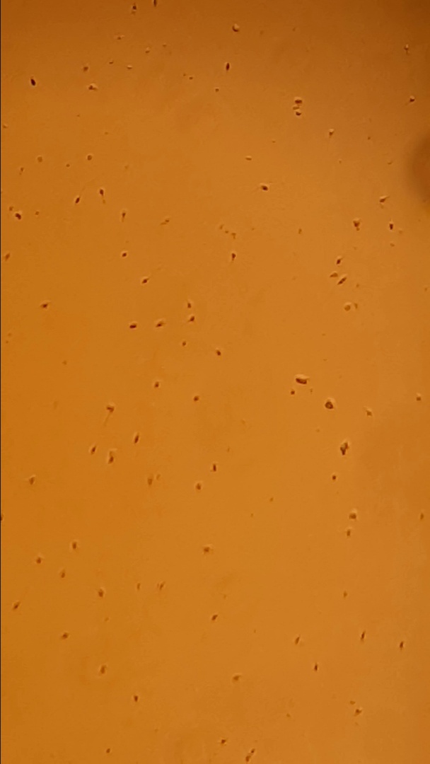 Sperm masking-orange Instance Segmentation Dataset by projects