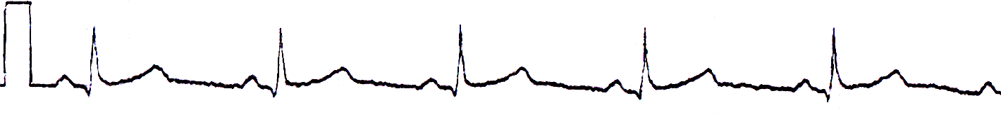 ECG Faster RCNN Object Detection Dataset and Pre-Trained Model by ThyeadiResearchUI