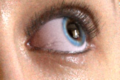 Detect-Cataract Object Detection Dataset and Pre-Trained Model by CDAC